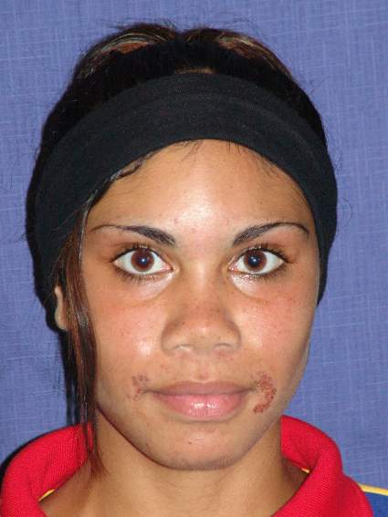 Djarragun College: L